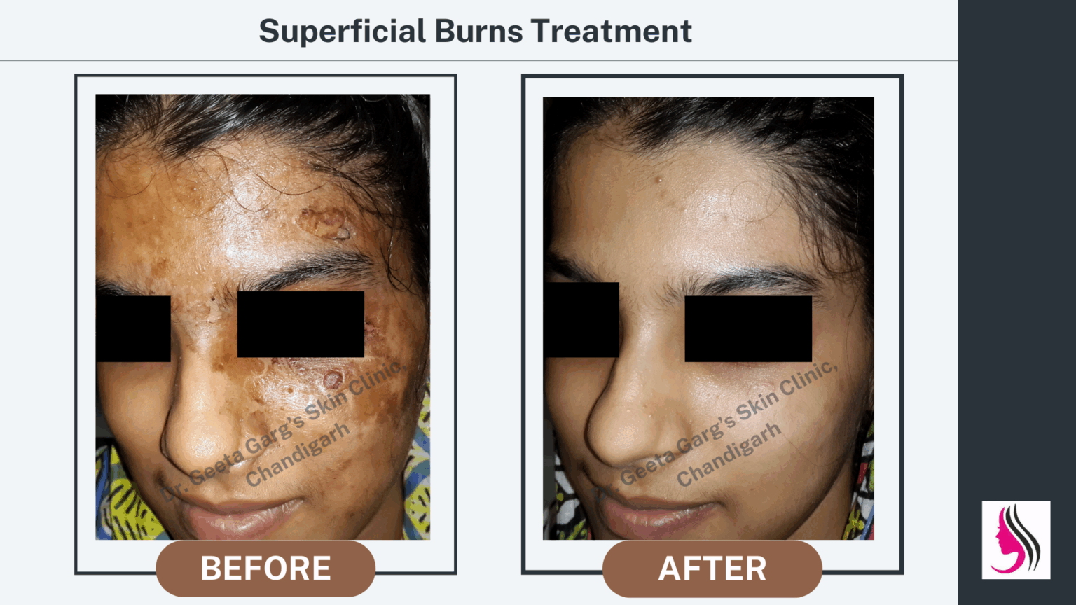 General Skin Treatments