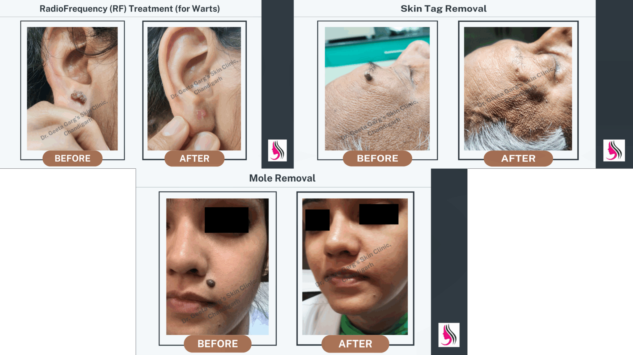 General Skin Treatments